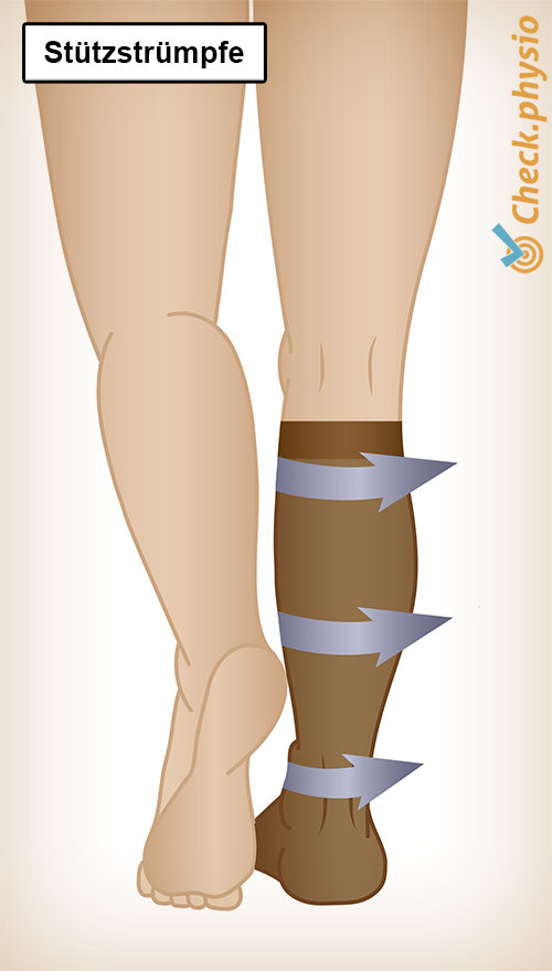 Ursache, Symptome & Behandlung | Beinthrombose - Physiotest.de